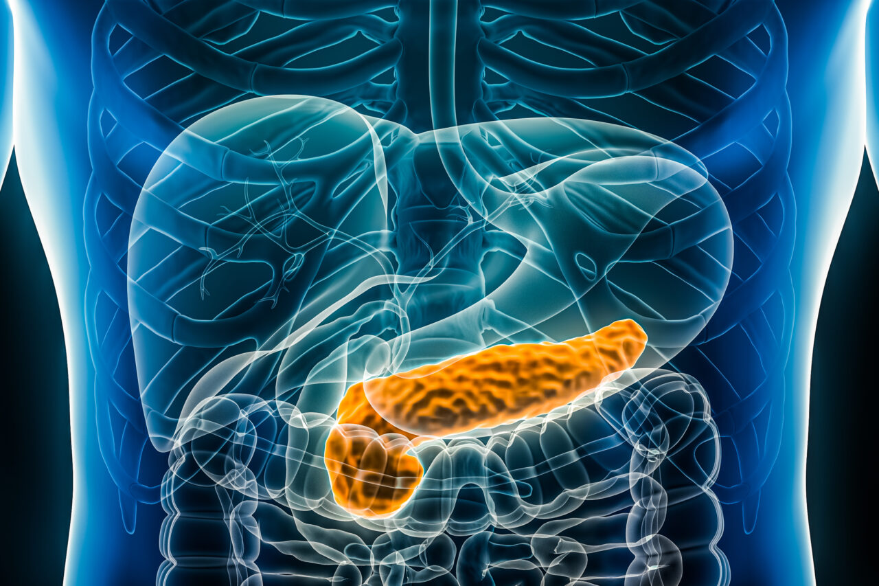 Pancreatitis: Recognizing Symptoms and Understanding Treatment — Gastro ...